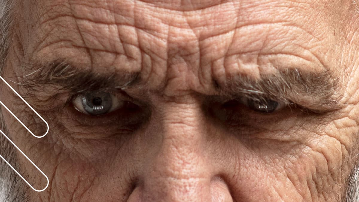 Entropión - ICQO | Instituto Clínico Quirúrgico de Oftalmología