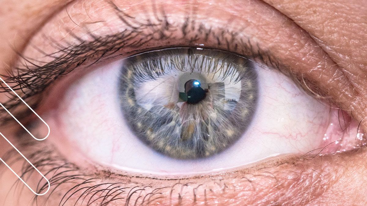 Lagoftalmos (parálisis faciales) - ICQO | Instituto Clínico Quirúrgico ...