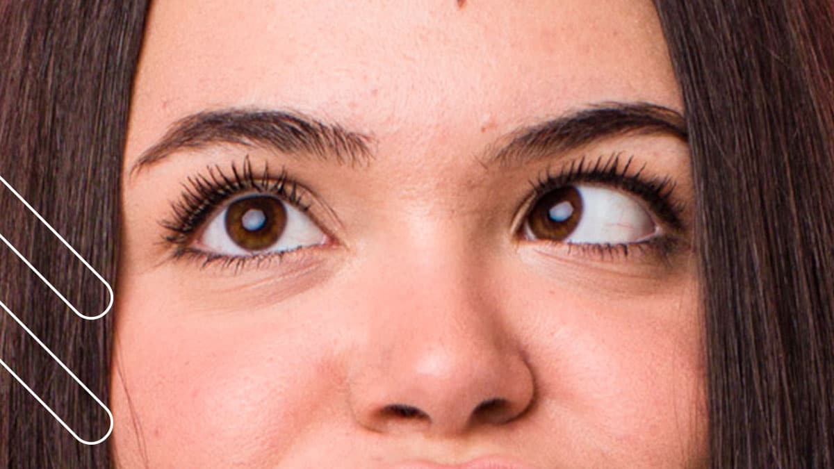 Nistagmus - ICQO | Instituto Clínico Quirúrgico de Oftalmología