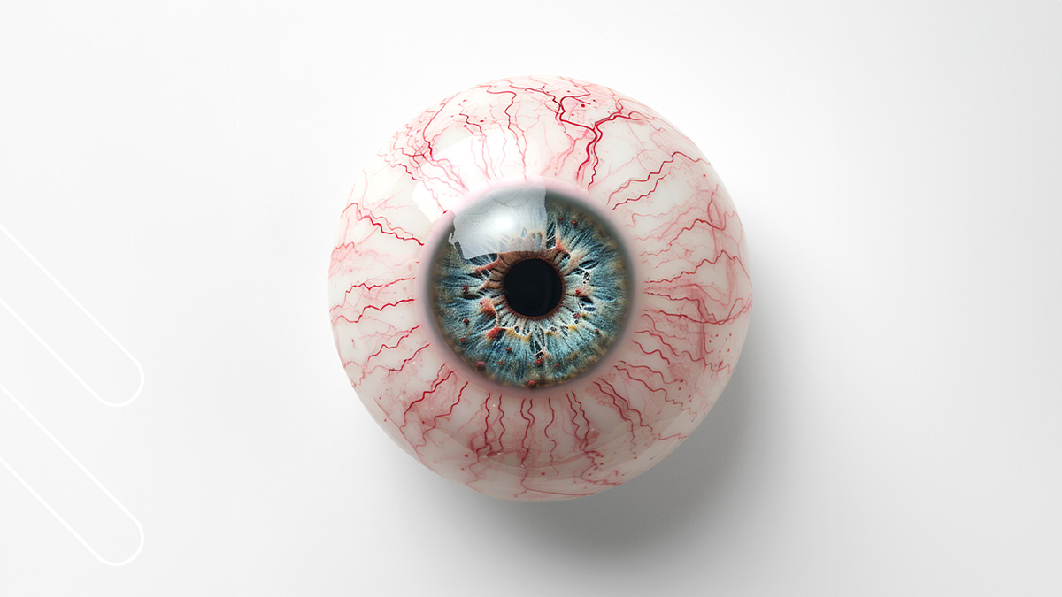 Dolor ocular - ICQO | Instituto Clínico Quirúrgico de Oftalmología